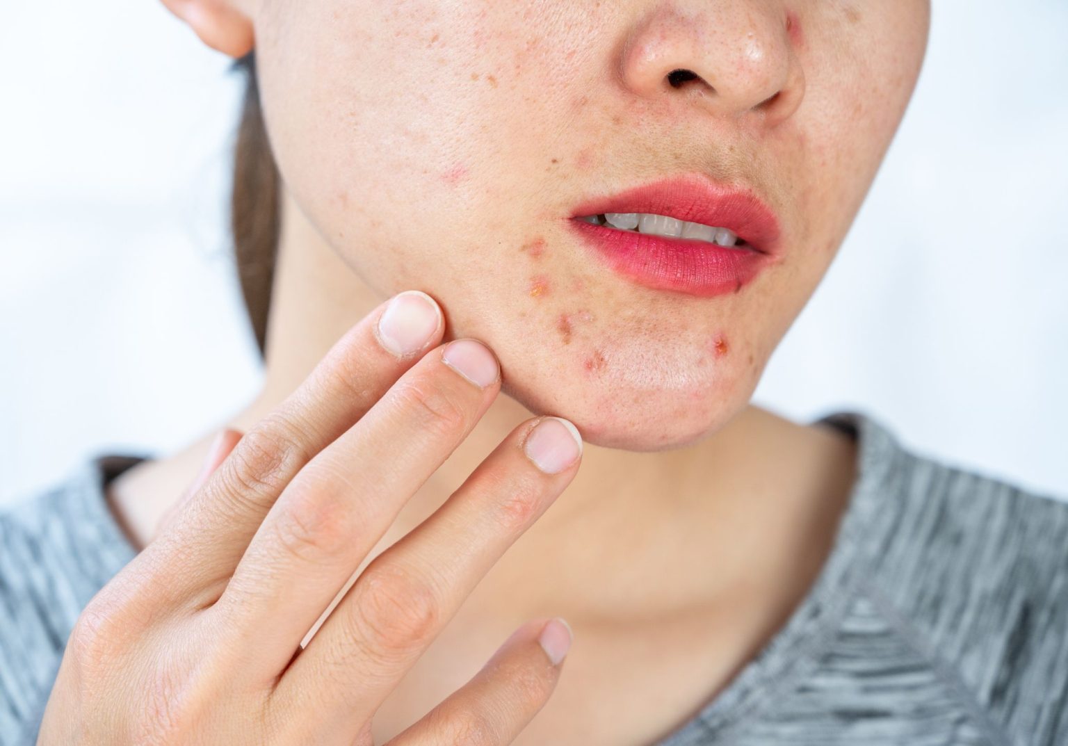 What Can Cause Red Dot To Appear On The Skin?